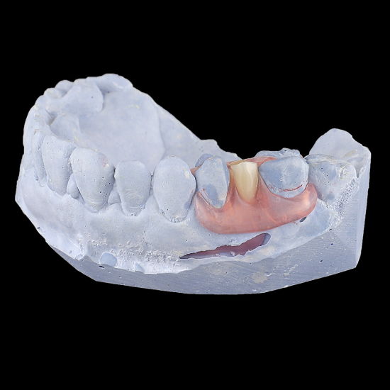China Valplast Teilprothesen Dentalbedarf Zahnkrone Dentaleinheit ...